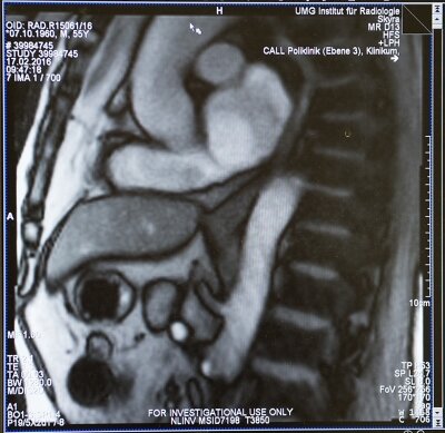 Echtzeit-MRT macht Ursachen sichtbar - MT-Dialog
