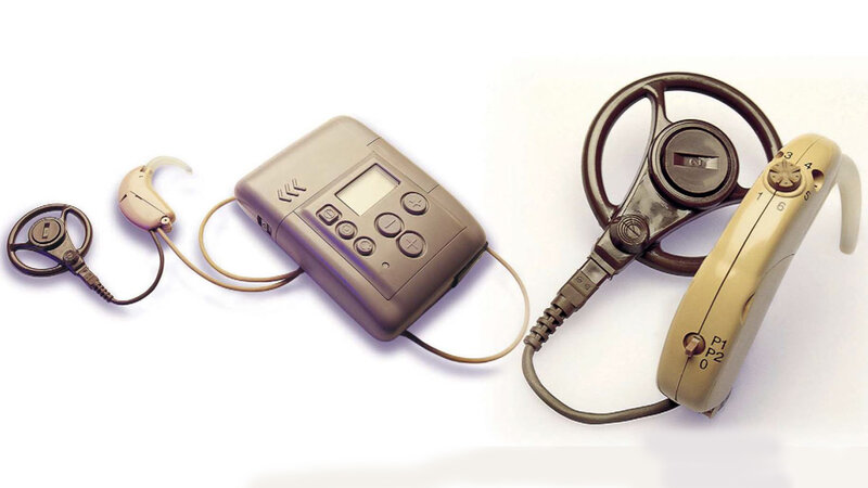 Die Geschichte des Cochlea-Implantats - MT-Dialog