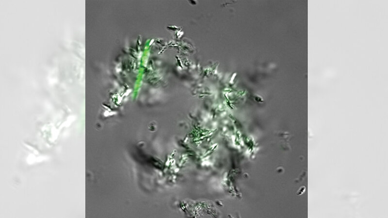 Verbesserter TBC-Test kann Resistenzen nachweisen - MT-Dialog