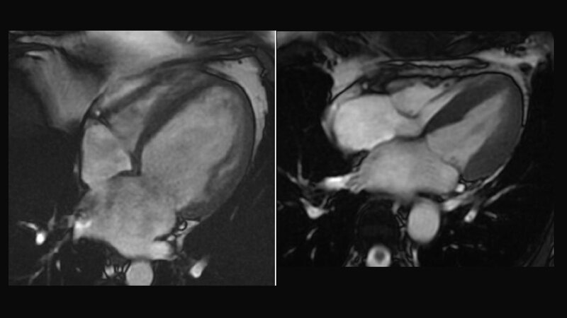 Den Geheimnissen der Herzzellen auf der Spur - MT-Dialog