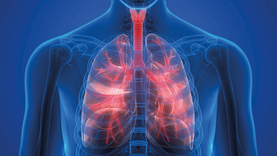 Sarkoidose – Funktionsdiagnostik und COVID-19 - MT-Dialog