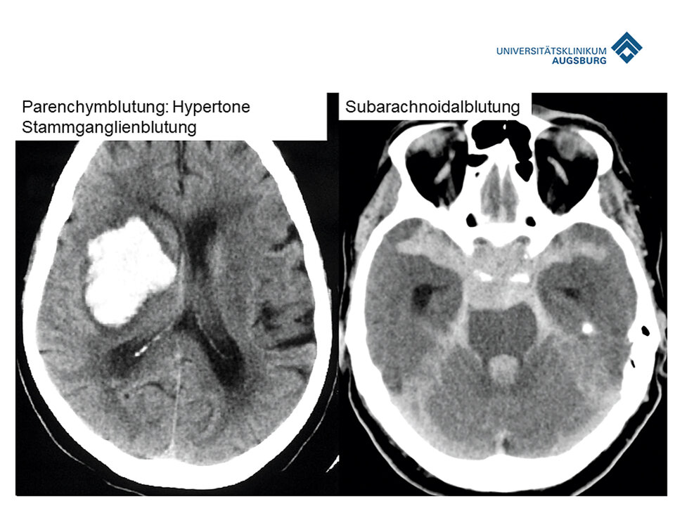 Herausforderungen bei Diagnose und Therapie - MT-Dialog