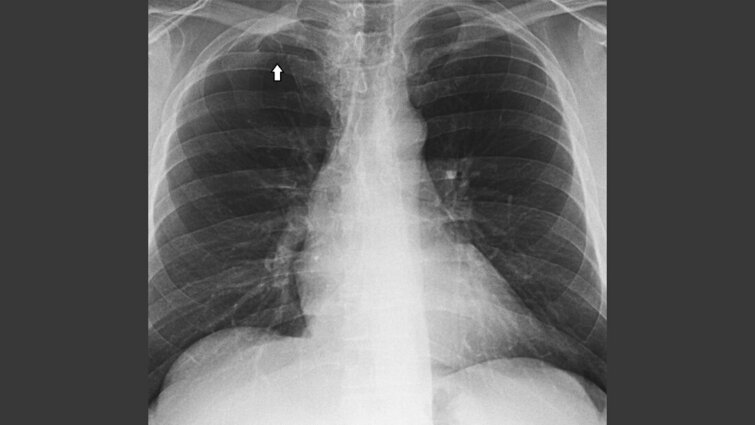 Anomalien und Normvarianten – ­Skelettale Veränderungen 3.37 ...