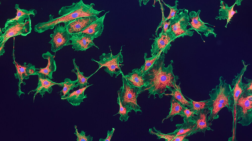Fibroblasten: Gelenkzerstörung und Aufbau - MT-Dialog