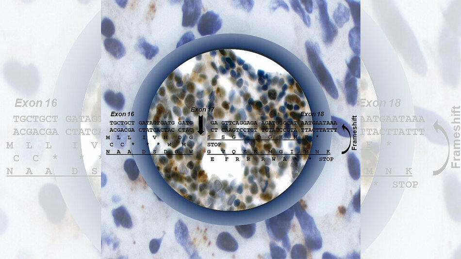 Neue Erkenntnisse zur Entstehung und Therapie von Krebs - MT-Dialog