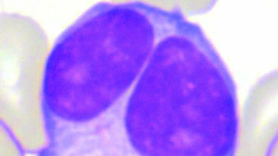 Binukleärer Lymphozyt - MT-Dialog