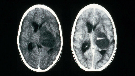 Radiological diagnosis of head injuries with a CT-Scan - MT-Dialog