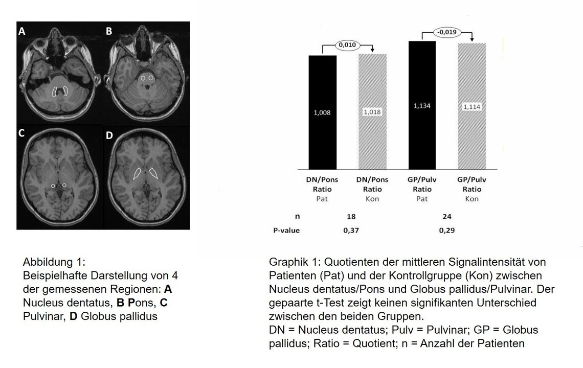 MRT-Kontrastmittel: Neue Studie spricht für Sicherheit - MT-Dialog