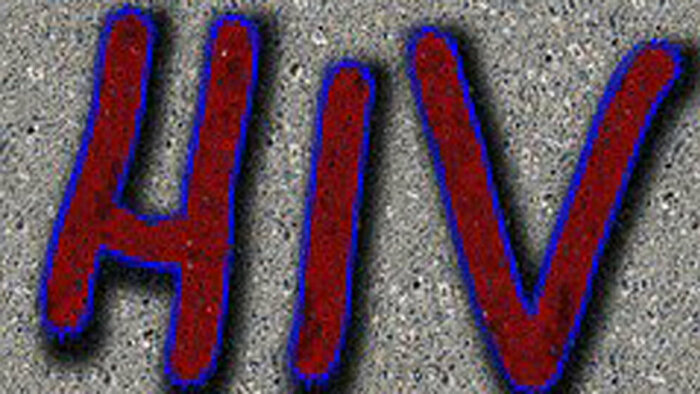 Neuer Elecsys-HIV-Duo-Test - MT-Dialog