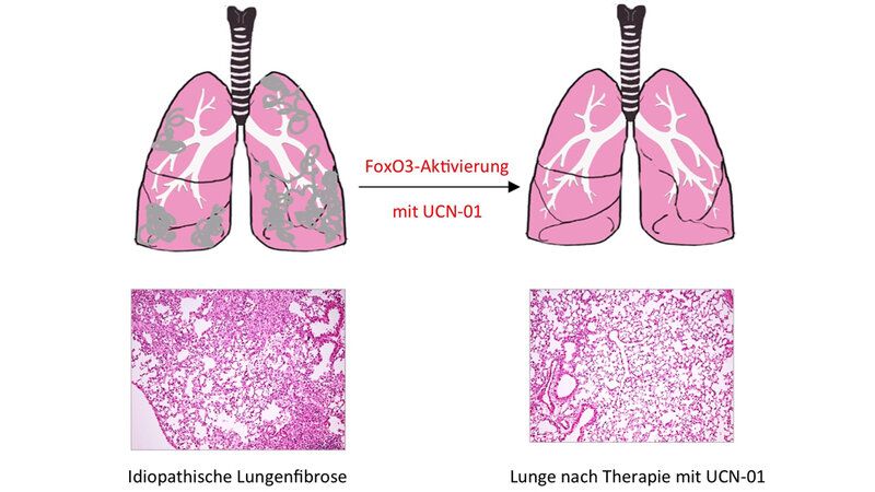 Einzelner Transkriptionsfaktor verantwortlich - MT-Dialog