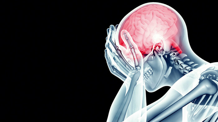 Schädel-Hirn-Trauma - MT-Dialog